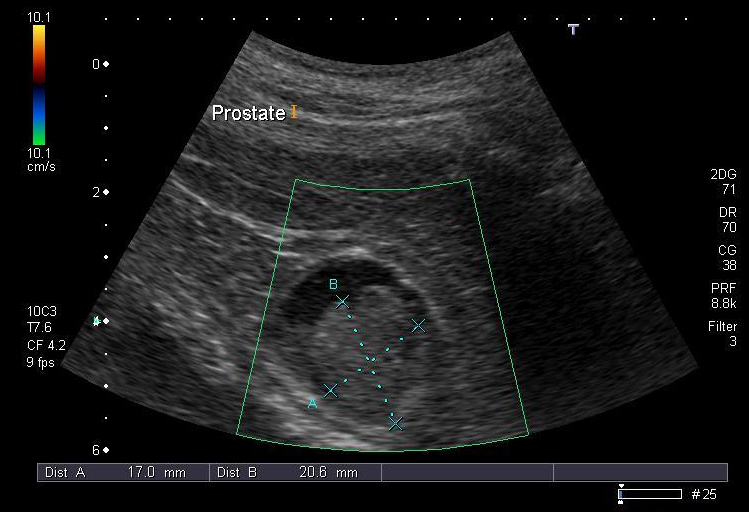 Prostate Study on a German Shepherd | Veterinary Imaging Center of San ...